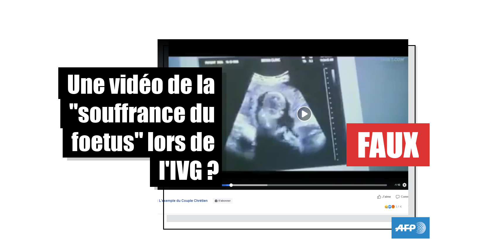 Une vidéo montrant la souffrance d'un embryon lors d'un avortement ...